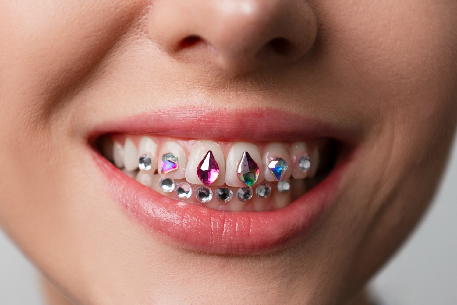 Tooth Gemstones: The Sparkling Smile Trend - ToothWiz Dental